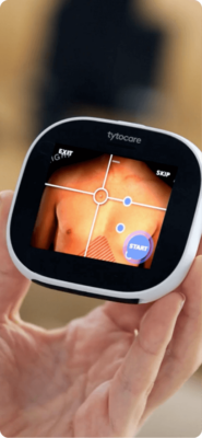 How it works - TytoCare